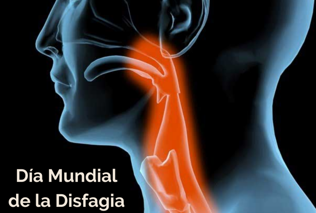 El 90% de las personas que padecen dificultades para tragar alimentos ...